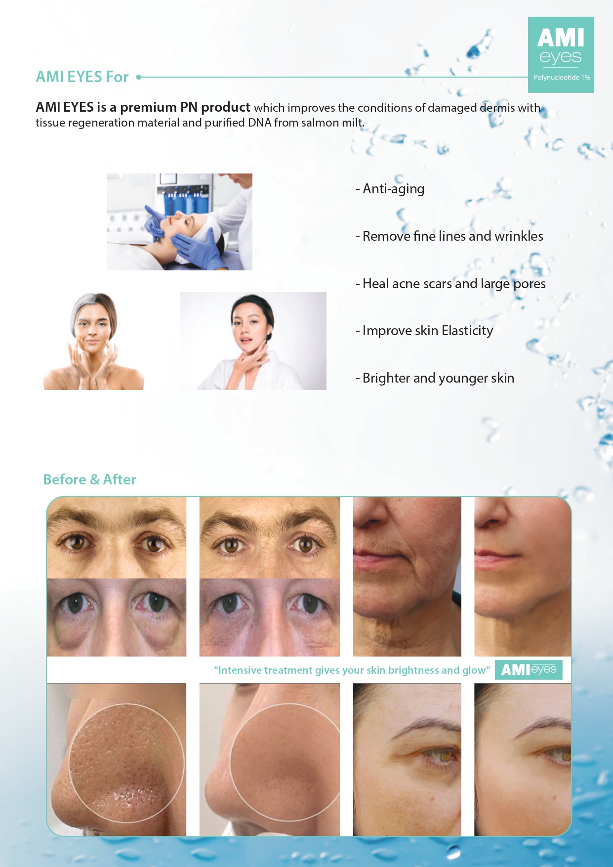 Ami Eyes - Buy Online Ami Eyes: Treatment, Before and After | To The Beauty